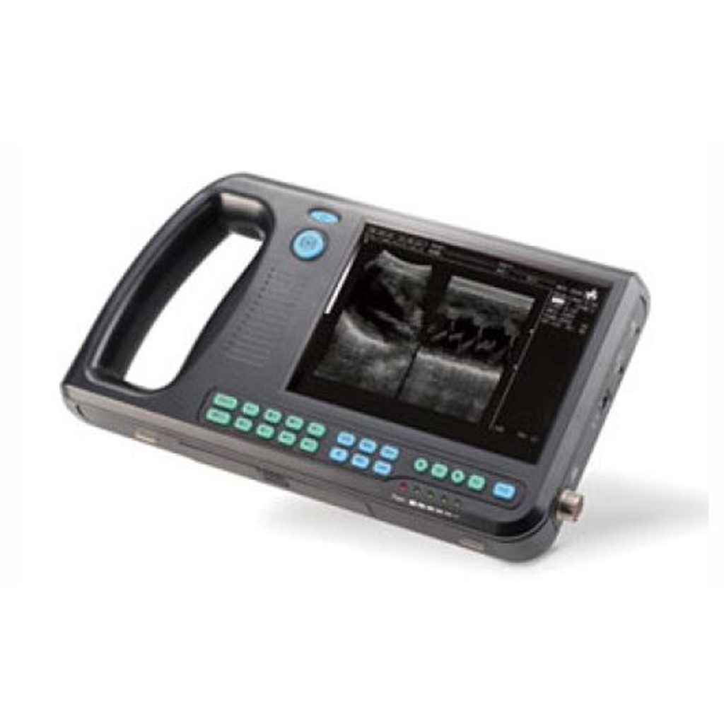 WED-3000 DIGITAL PALM SMART ULTRASOUND SCANNER WED-3000 – MedCorp